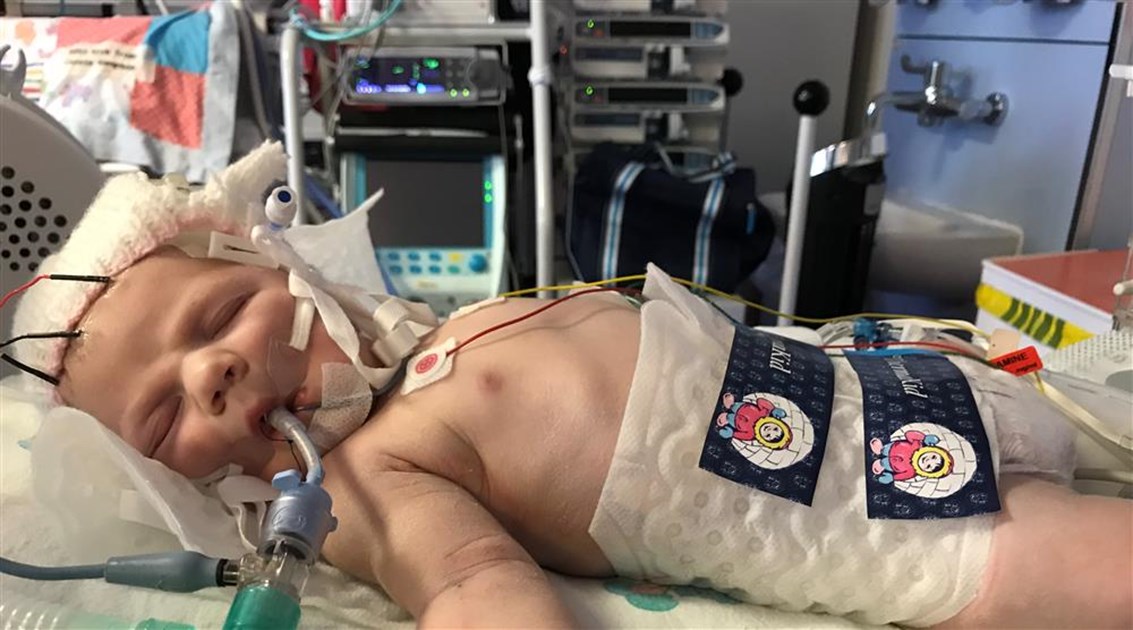 Patrick Holmes is fundraising for SSNAP