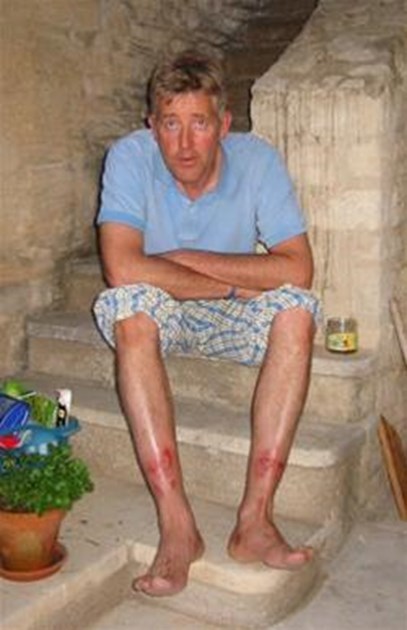 Peter Hartnett is fundraising for O2e