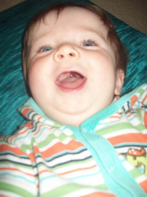 Emily Mustoe is fundraising for Cleft Lip And Palate Association