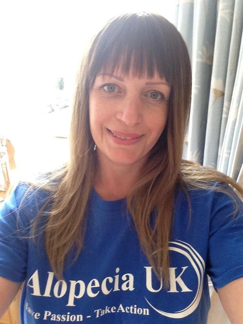 Juliette Cutting is fundraising for Alopecia UK
