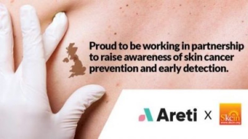 Marcus Beauchamp is fundraising for SKCIN - The Karen Clifford Skin ...