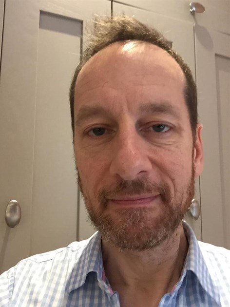 Peter Burrows is fundraising for Bowel Cancer UK