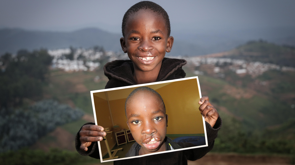 Amy Mactavish is fundraising for The Smile Train