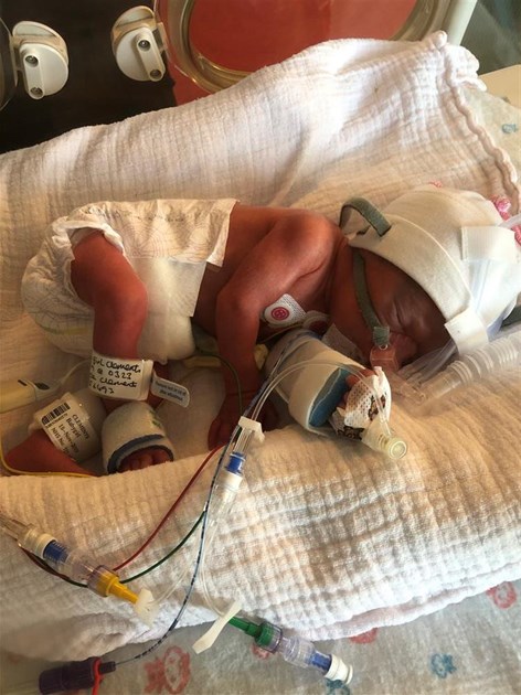 Oliver Taylor is fundraising for Bibs Babies In Buscot Support