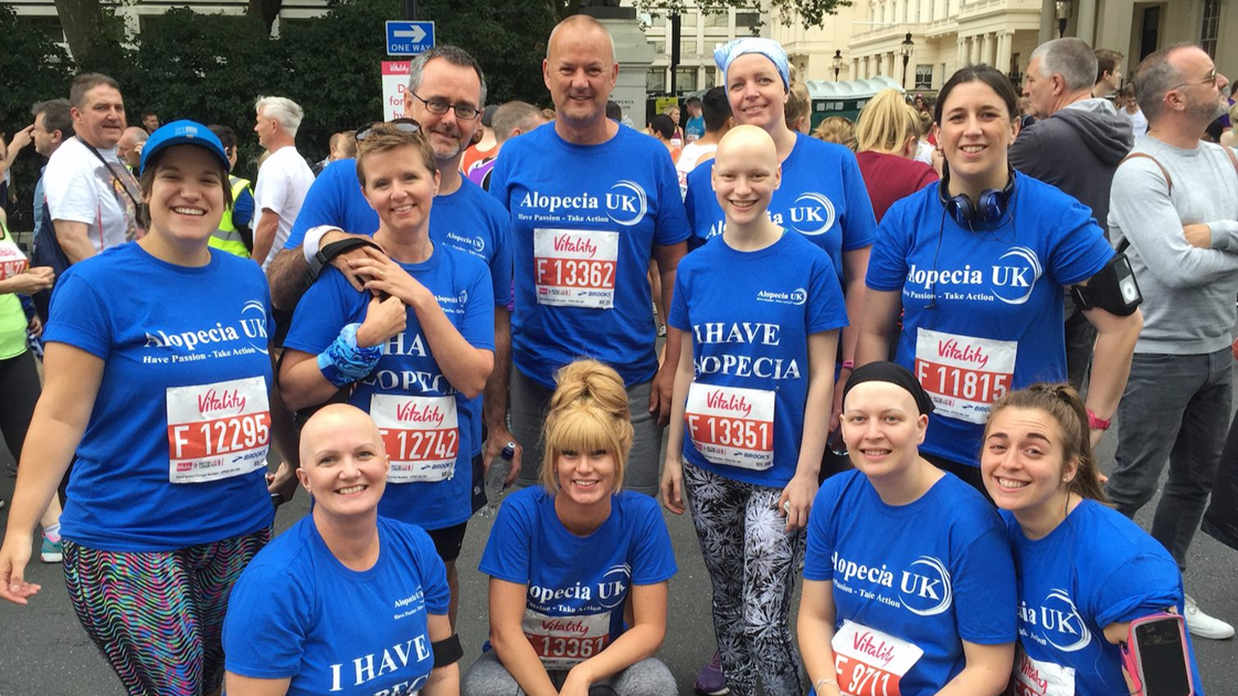 Ross Pole is fundraising for Alopecia UK
