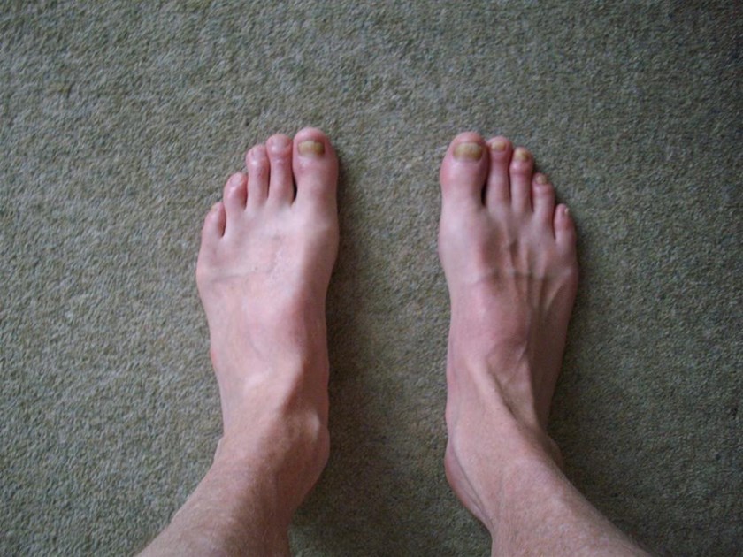 Brian Turton is fundraising for Hospice UK