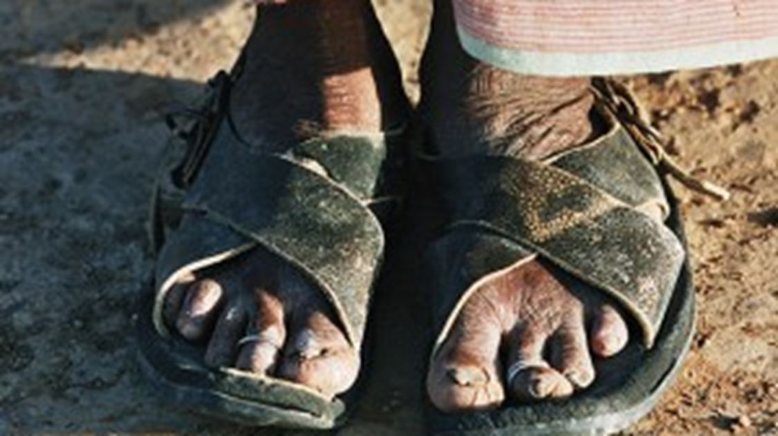 Kyle Petrie is fundraising for The Mission to End Leprosy