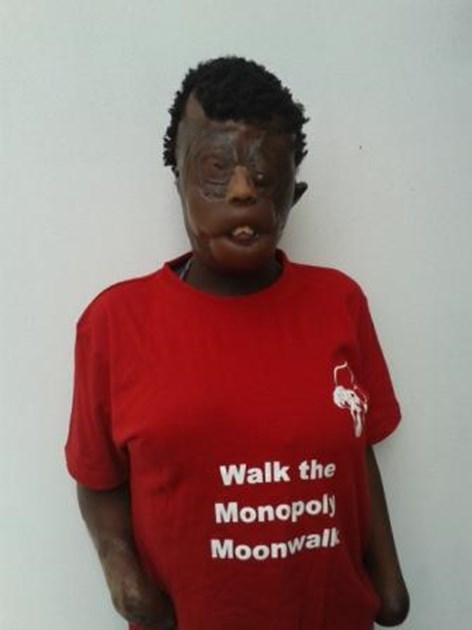 Dorah Jones is fundraising for Children of Fire International