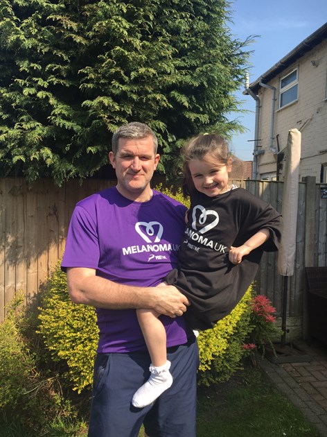 Mark Culbert is fundraising for Melanoma UK