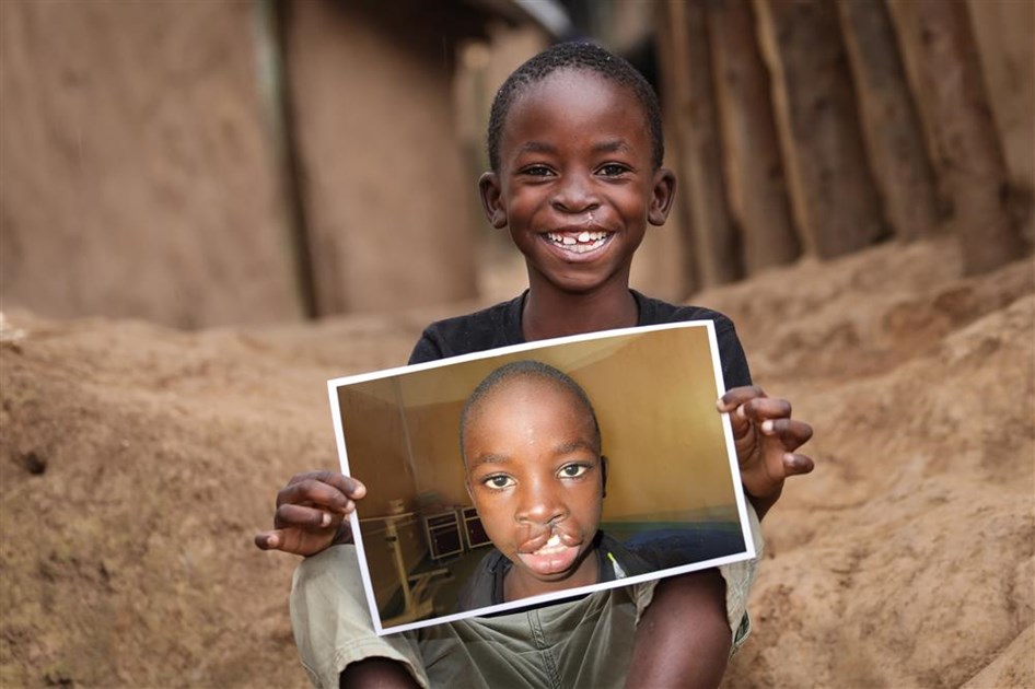 Ian Vallance is fundraising for The Smile Train