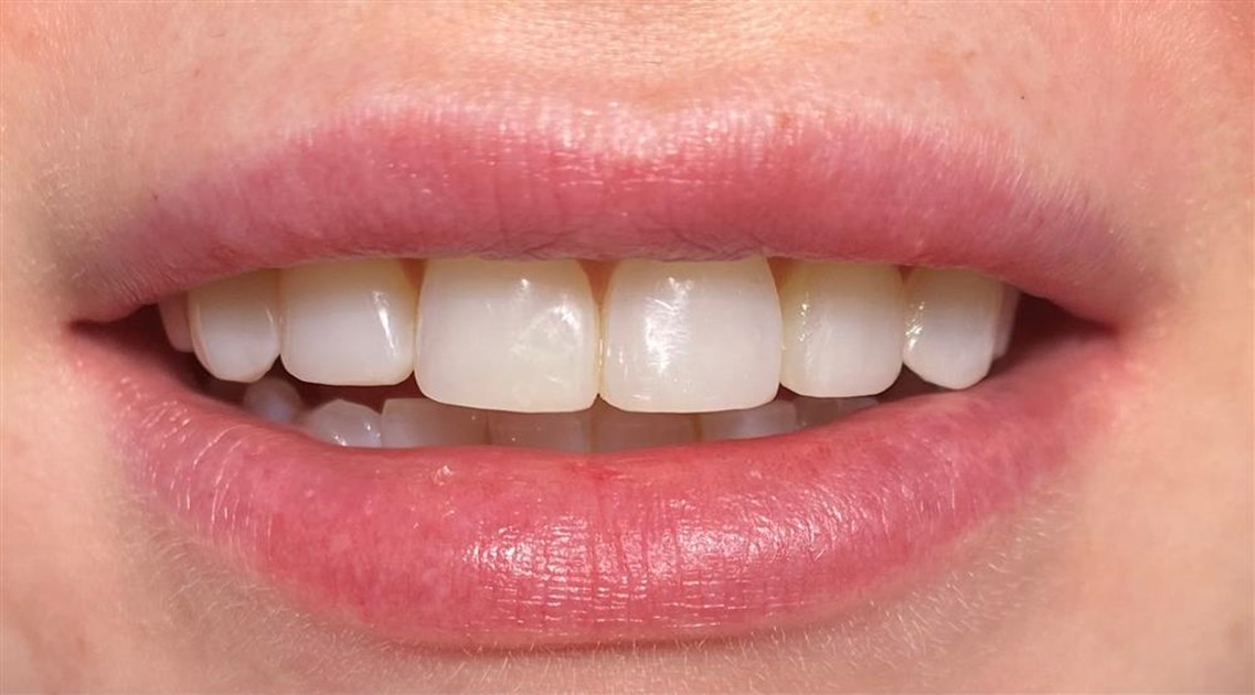 Stephanie Downes is fundraising for UNICEF UK