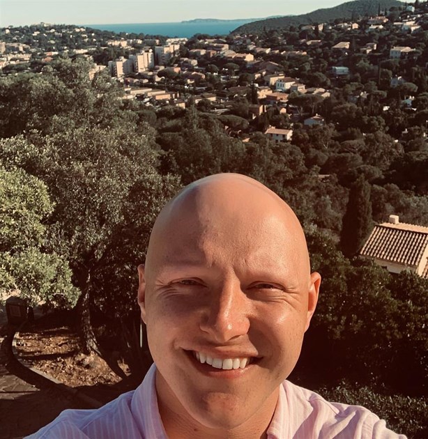 Nick Craze is fundraising for Alopecia UK