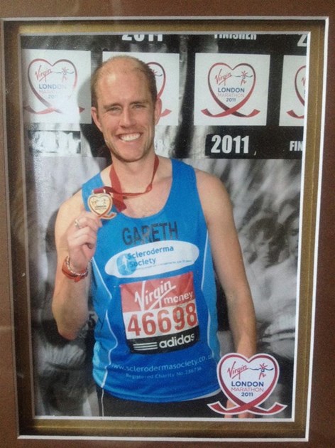 Gareth Clifton is fundraising for The Scleroderma Society