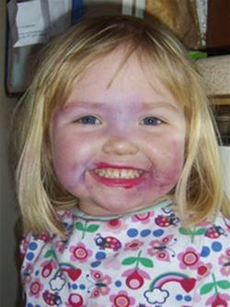 Lily Rowe is fundraising for Cancer Research UK