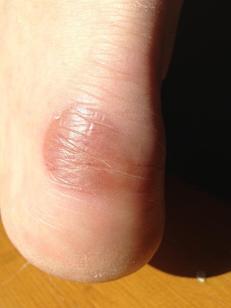 Loarn McCutcheon is fundraising for ChildLine