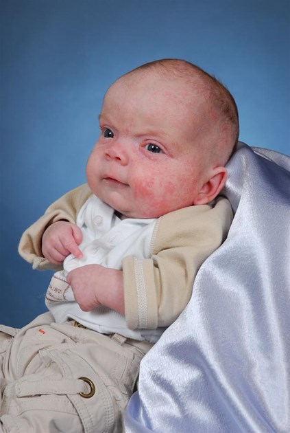 Michelle Appleton is fundraising for Meningitis Research Foundation