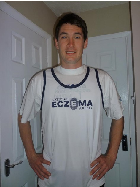 Paul Budden is fundraising for National Eczema Society Paul Budden is fundraising for National Eczema Society