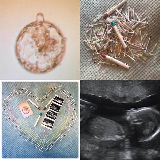 Murray Legg is fundraising for Babble Giving