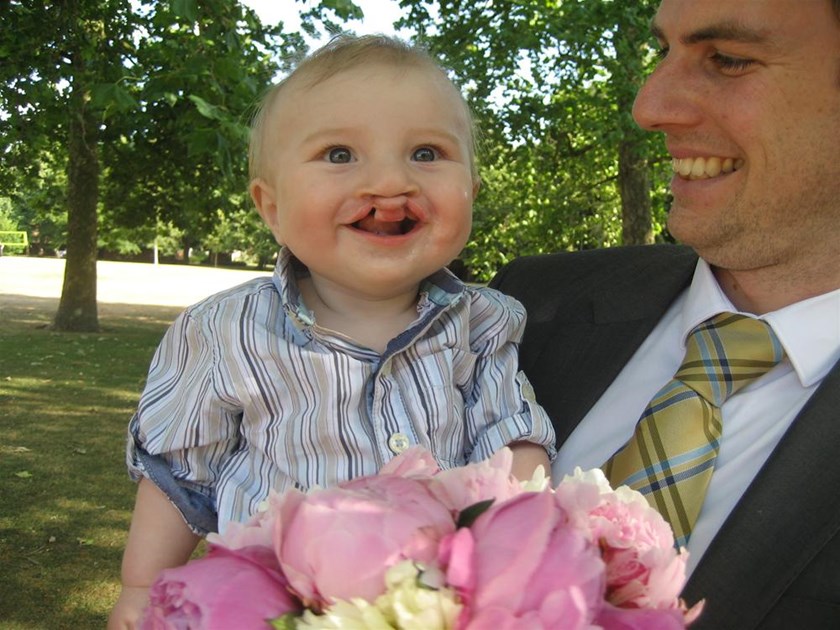 Rob Sayward is fundraising for Cleft Lip & Palate Action (CLAPA)
