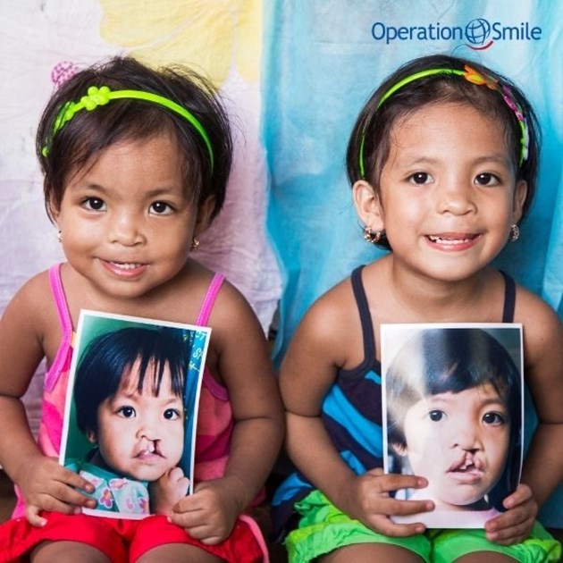 Smita Mohite is fundraising for Operation Smile United Kingdom