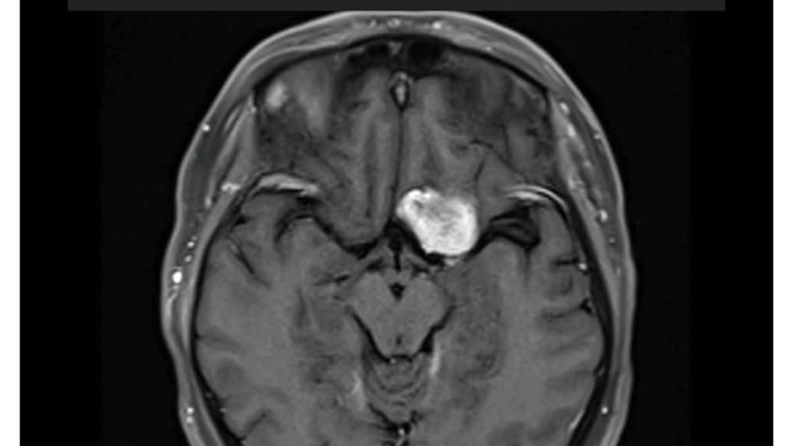 Sarah Whyatt is fundraising for Brain Tumour Research