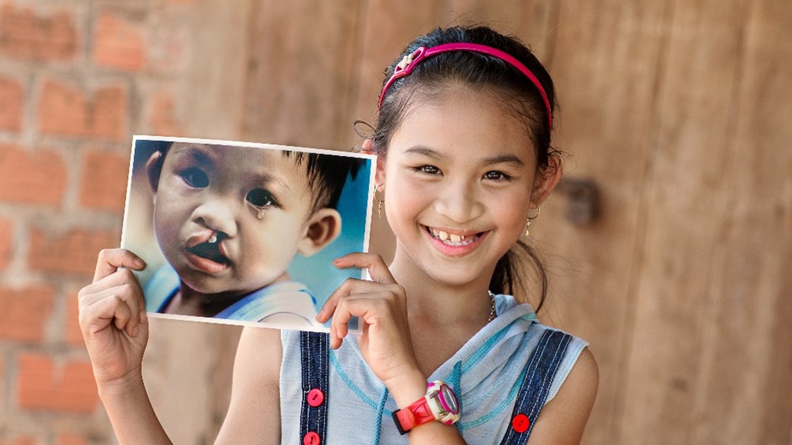 Harriet Jackson is fundraising for Operation Smile United Kingdom