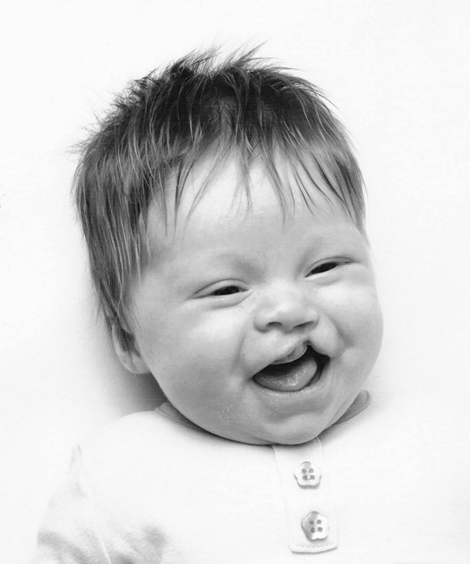 Martyn Walker is fundraising for Cleft Lip And Palate Association