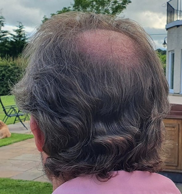 Michael Edie is fundraising for Cancer Research UK