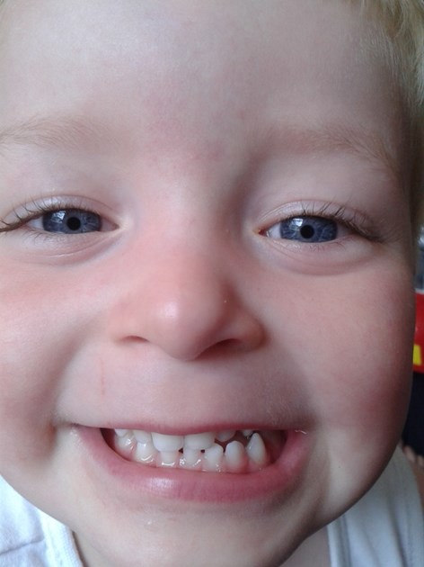 Sam Gregory is fundraising for BBC Children in Need