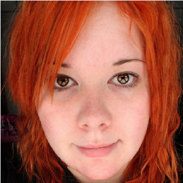 Kirsty Sawyer is fundraising for Alopecia UK