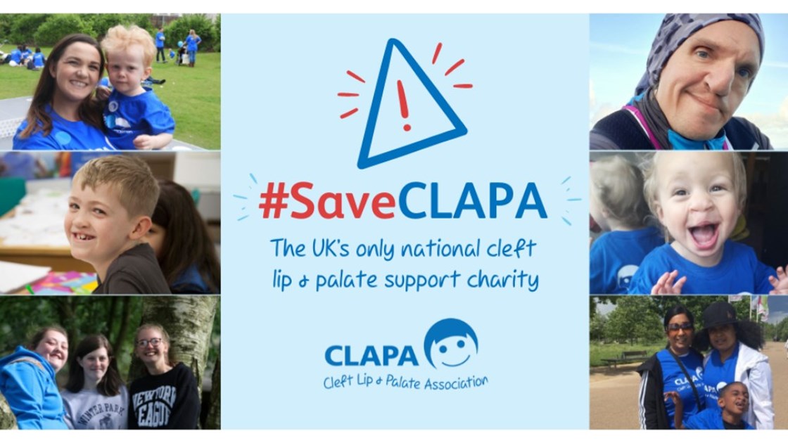 Sinead-Rose Gemmell is fundraising for Cleft Lip And Palate Association