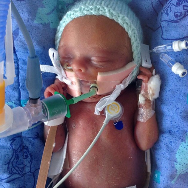 Bailey Chantler is fundraising for Friends of SCBU Jersey