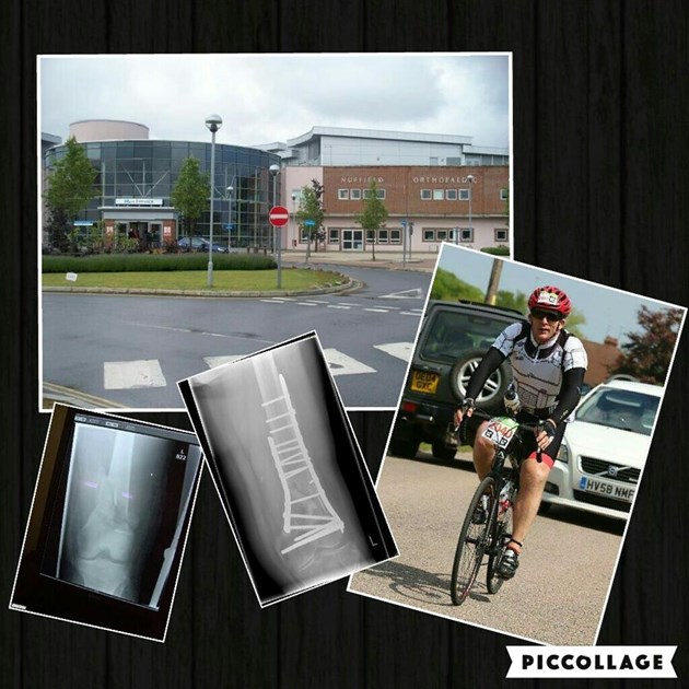 Mark Tootell is fundraising for Nuffield Orthopaedic Centre Appeal