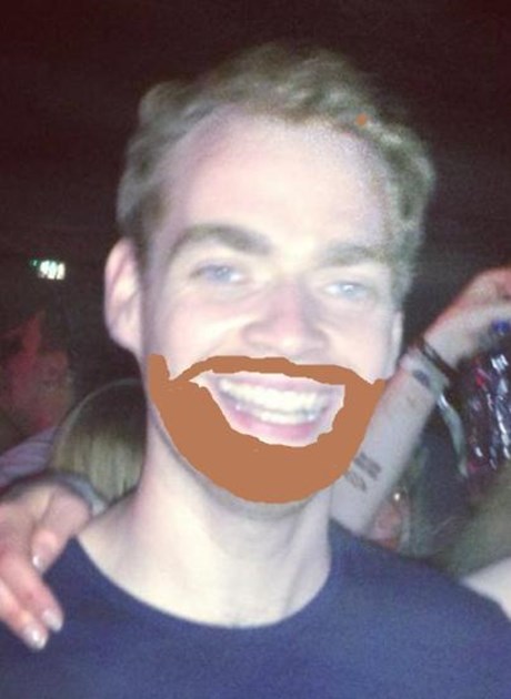 Nicholas Jones Is Fundraising For Beating Bowel Cancer