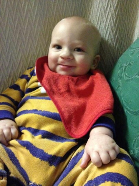 Emma Iles is fundraising for Cleft Lip And Palate Association