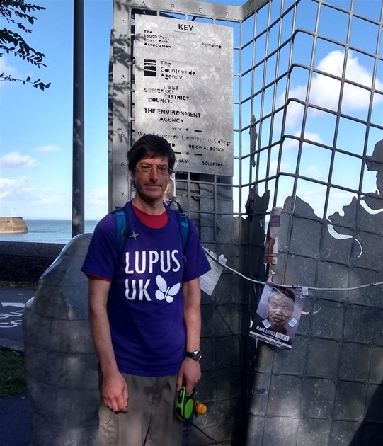 Andrew Watts is fundraising for LUPUS UK
