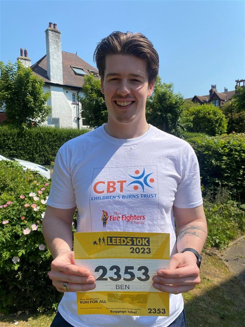 Ben Wragg is fundraising for Children's Burns Trust