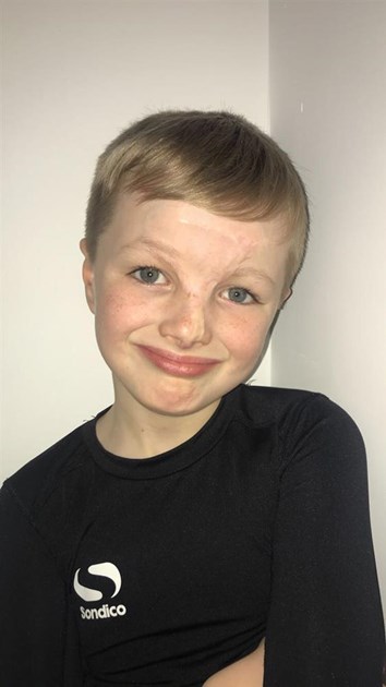 Kimberley Graver is fundraising for Changing Faces