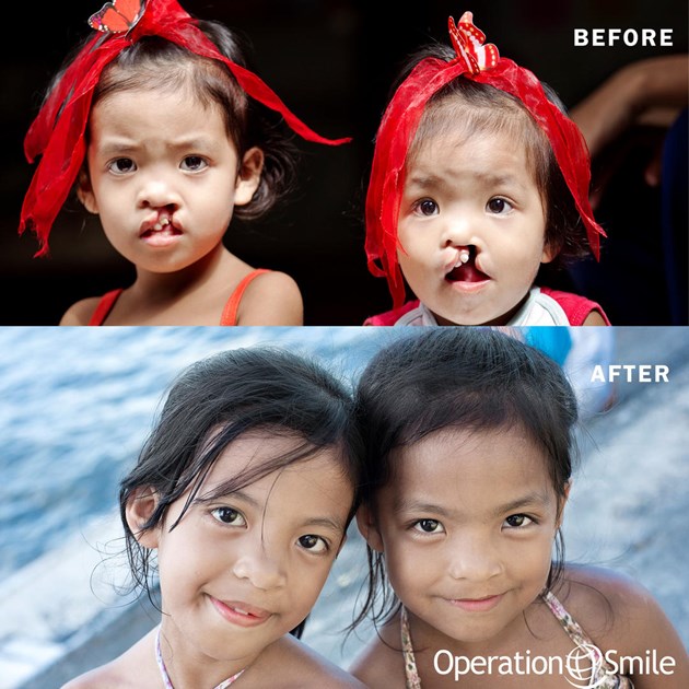 Paul Clutterbuck is fundraising for Operation Smile United Kingdom