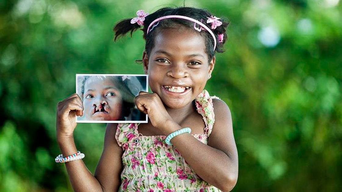 Karl Olley is fundraising for Operation Smile United Kingdom