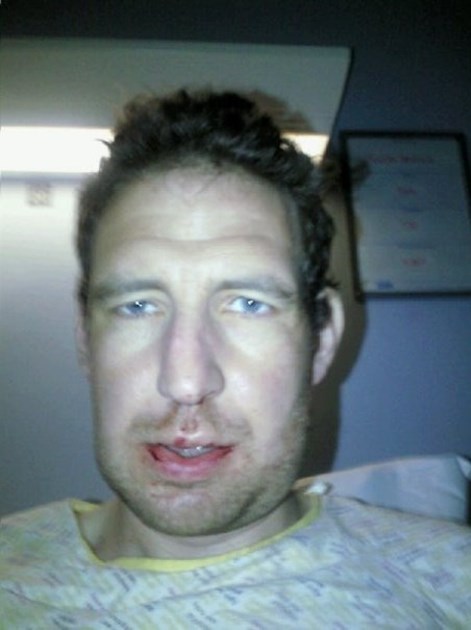 tim heming is fundraising for The Facial Surgery Research Foundation ...