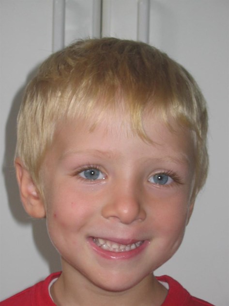 Dan Nuttall is fundraising for Cleft