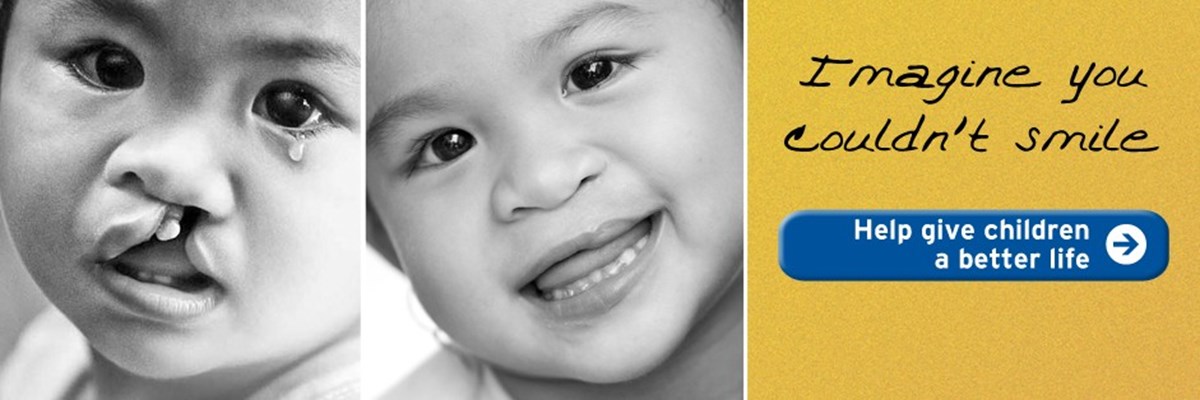 Paul Clutterbuck is fundraising for Operation Smile United Kingdom