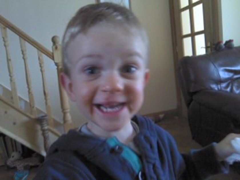 Steven Dunlop is fundraising for Cleft Lip And Palate Association