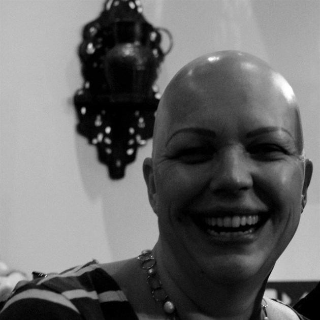 Anna Preedy is fundraising for Alopecia UK