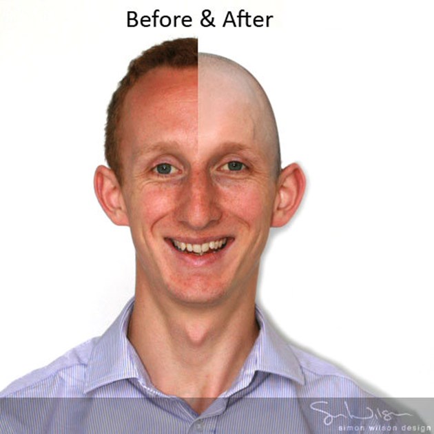 Simon Wilson is fundraising for Teenage Cancer Trust