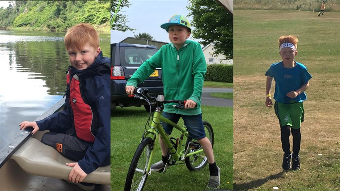 Gareth Watson is fundraising for Alopecia UK