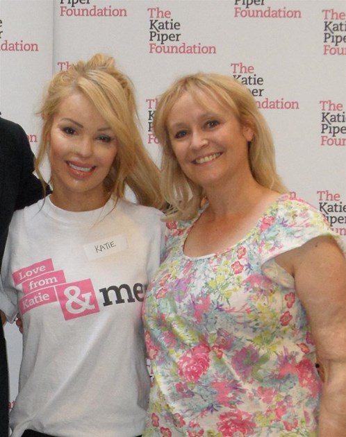 Tracey berry is fundraising for Katie Piper Foundation