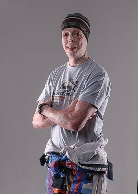 martyn compton is fundraising for KartForce