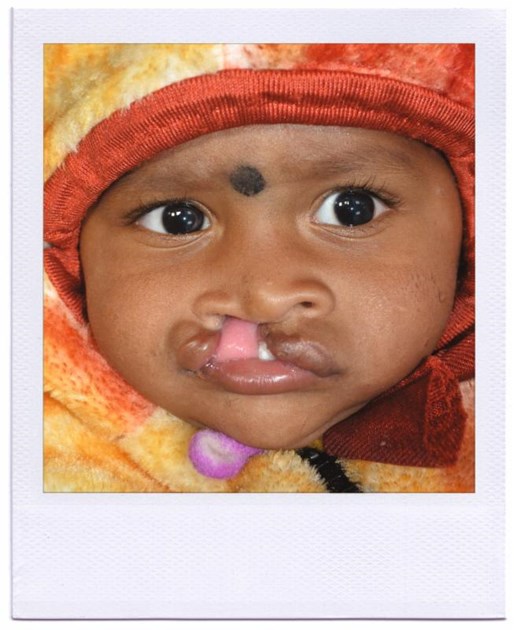 Paul Clutterbuck is fundraising for Operation Smile United Kingdom